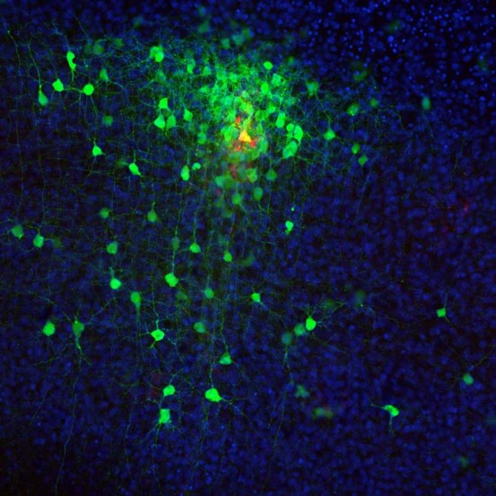 Gene Transfer, Targeting and Therapeutics Viral Vector Core - Salk ...