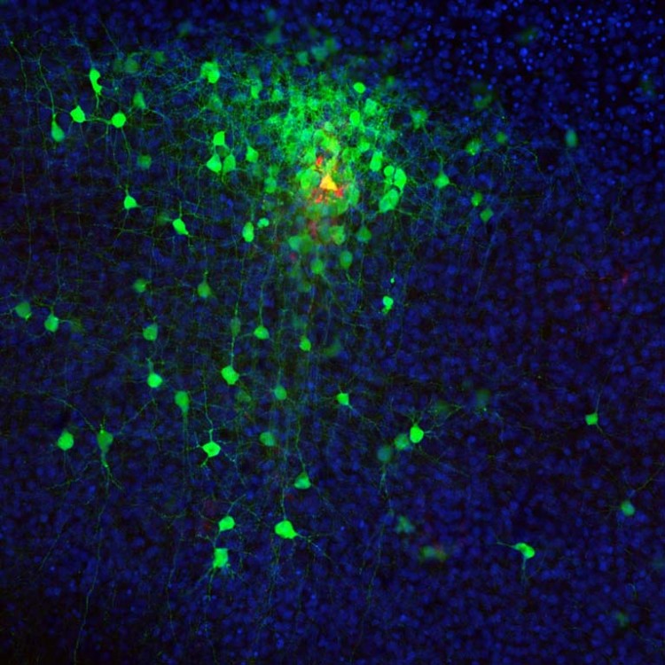 Gene Transfer, Targeting and Therapeutics Viral Vector Core - Salk ...