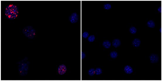 Turning back time: Salk scientists reverse signs of aging - Salk ...